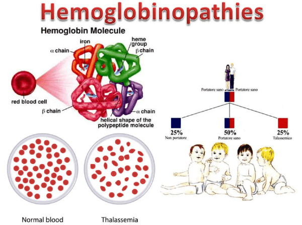 Hemoglobinopathy - Dr Akshay Lahoti